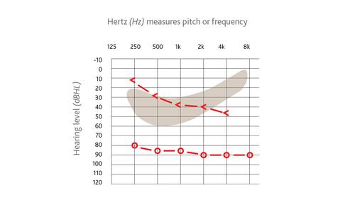 Understanding your audiogram