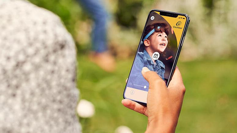 Baha® Smart App Overview | Cochlear