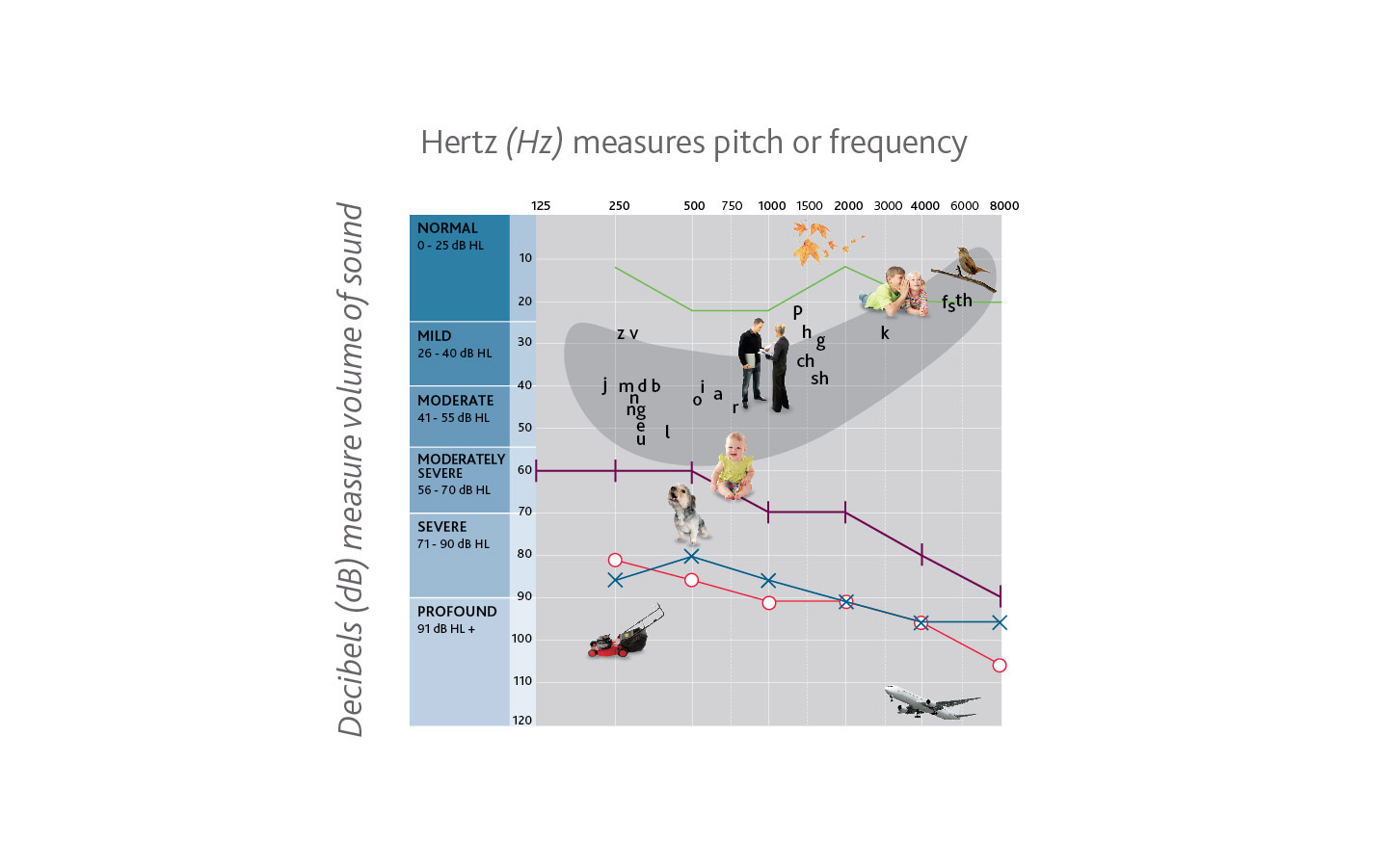 Comprendre l’audiogramme