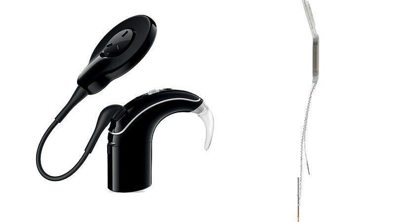 About cochlear implants