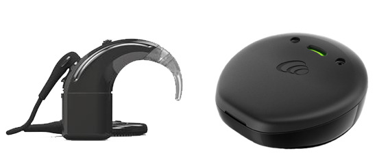 Unilateral hearing loss | Single-sided deafness | Cochlear